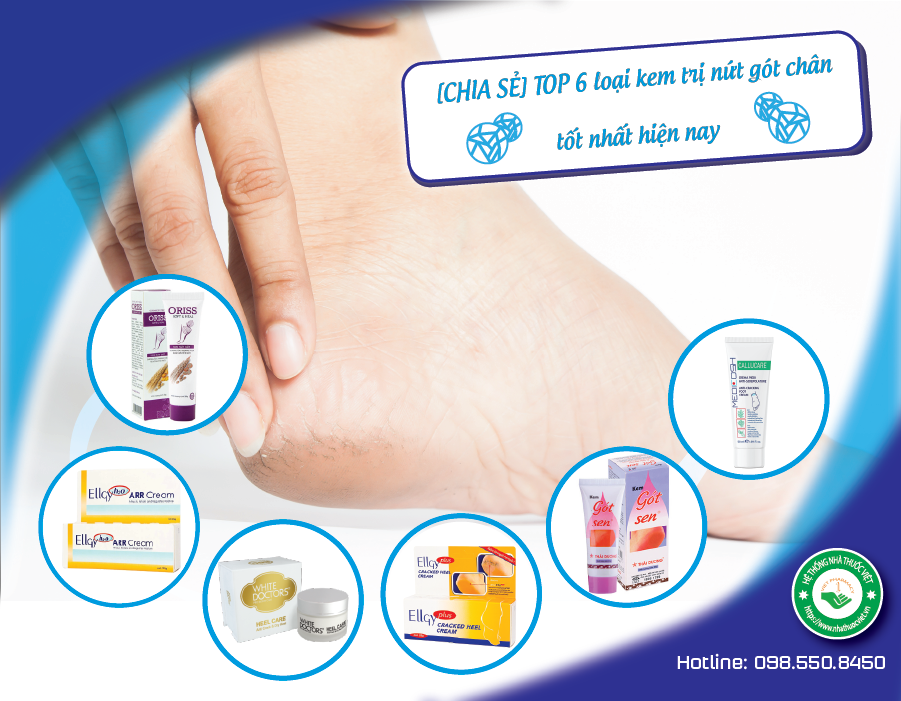[CHIA SẺ] TOP 6 loại kem trị nứt gót chân tốt nhất hiện nay