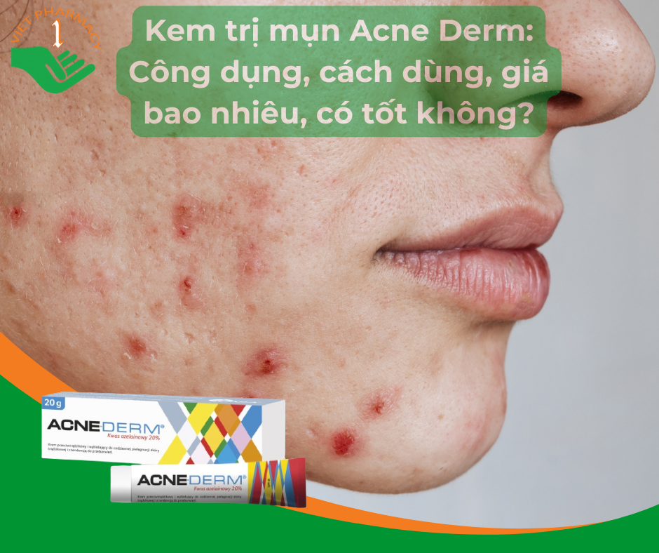 Kem trị mụn Acne Derm: Công dụng, cách dùng, giá bao nhiêu, có tốt không?