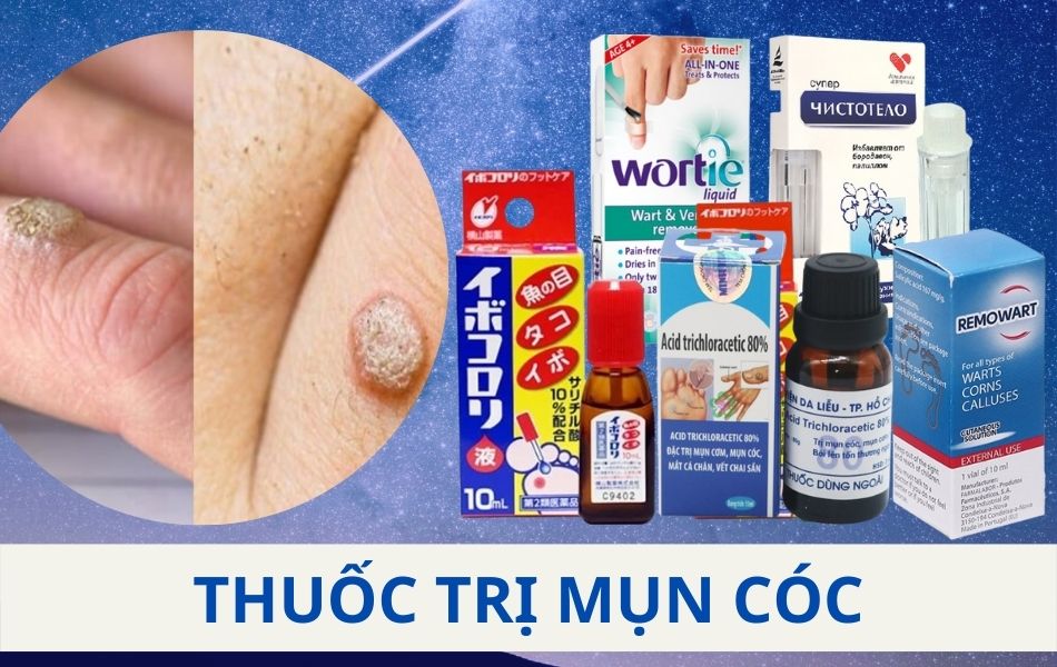 Review top 5 dung dịch, thuốc trị mụn cóc hiệu quả và an toàn