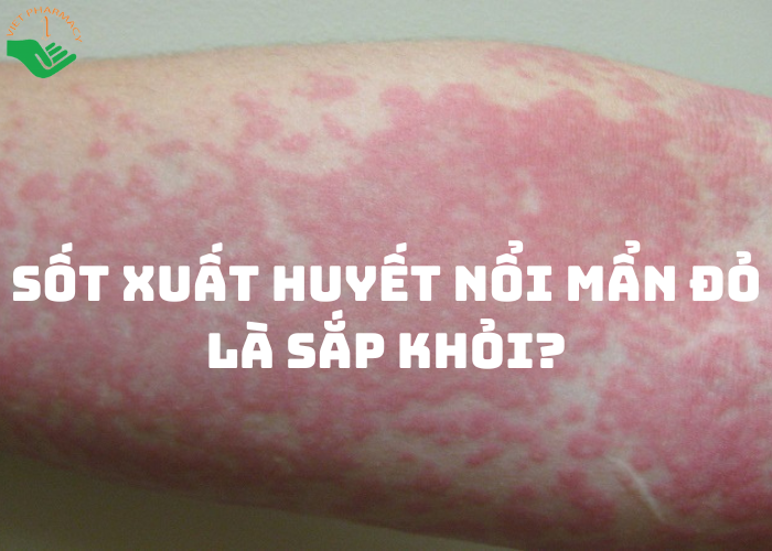 Giải đáp: Sốt xuất huyết nổi mẩn đỏ là sắp khỏi đúng không?
